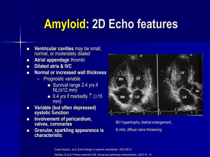 PPT - Restrictive Cardiomyopathy PowerPoint Presentation - ID:1778054