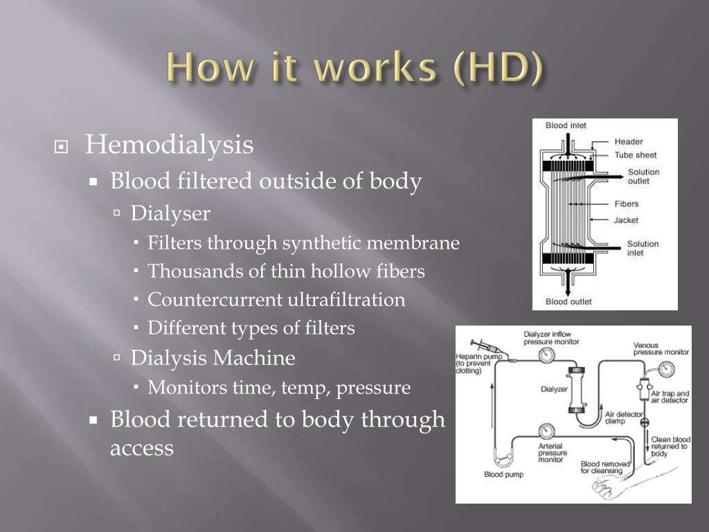 PPT - Dialysis Treatment for Kidney disease PowerPoint Presentation ...