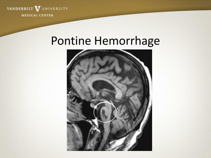 PPT - Diagnosis and Management of Acute Stroke PowerPoint Presentation ...