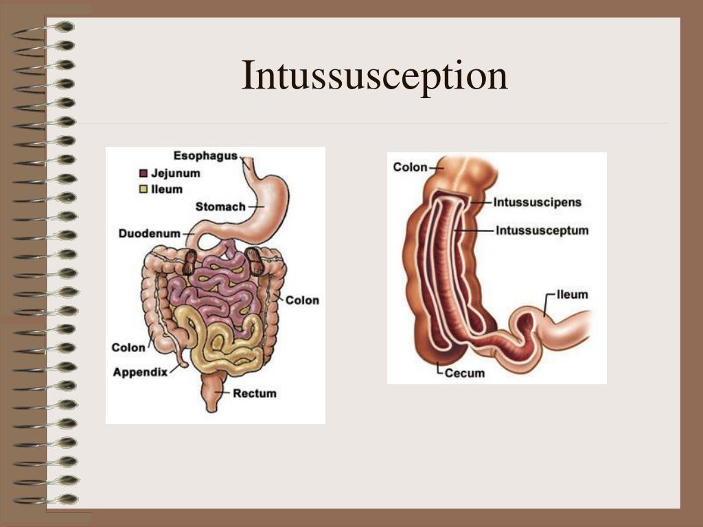 Ppt Highlights Of The Developing Gastrointestinal System Powerpoint
