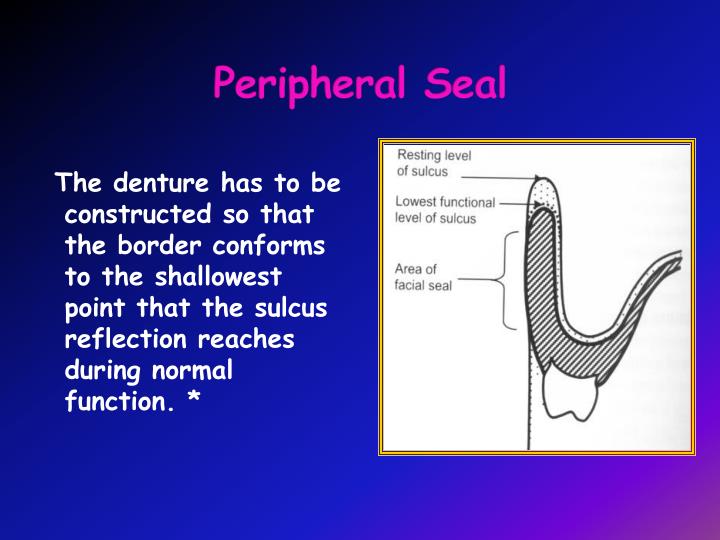 PPT - Retention, Stability & Support PowerPoint Presentation - ID:1781221
