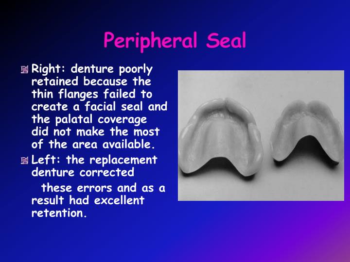 PPT - Retention, Stability & Support PowerPoint Presentation - ID:1781221