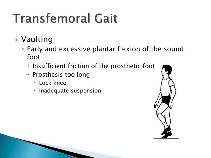 PPT - Gait Deviations in Transfemoral and Transtibial Amputees ...