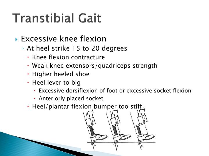 PPT - Gait Deviations in Transfemoral and Transtibial Amputees ...