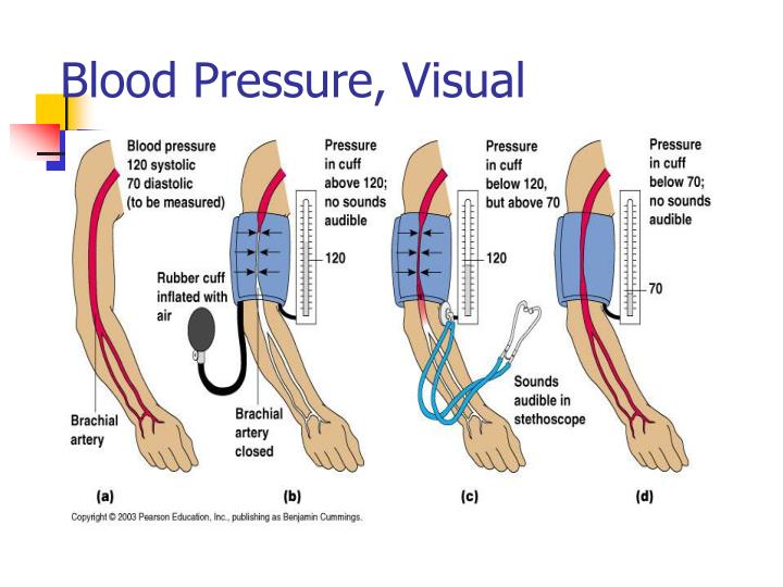 PPT - Chapter 11 The Cardiovascular System PowerPoint Presentation - ID ...
