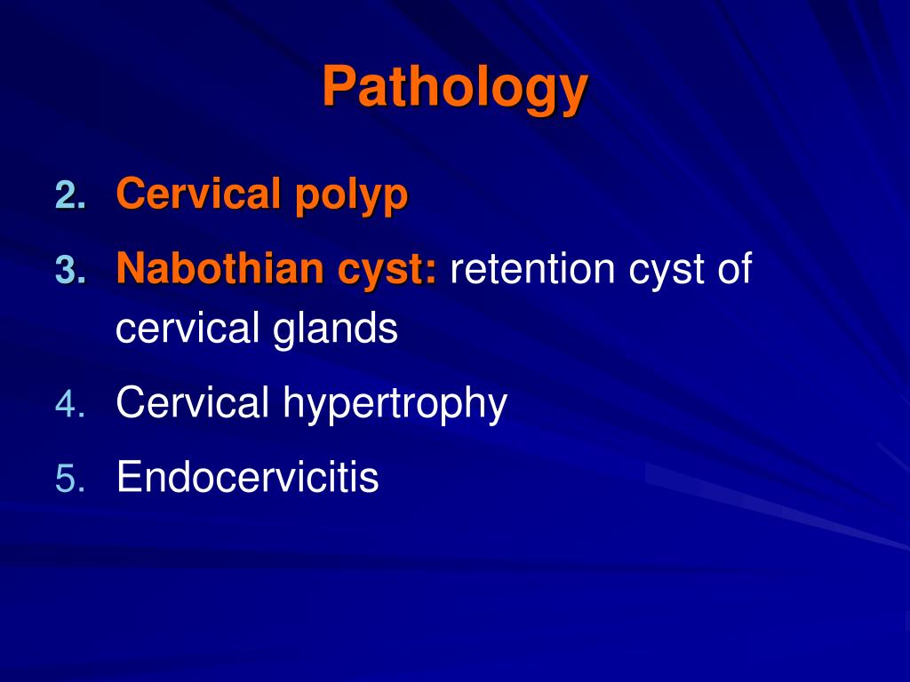 PPT - Infection of female reproductive system PowerPoint Presentation ...