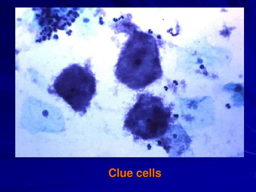 PPT - Infection of female reproductive system PowerPoint Presentation ...