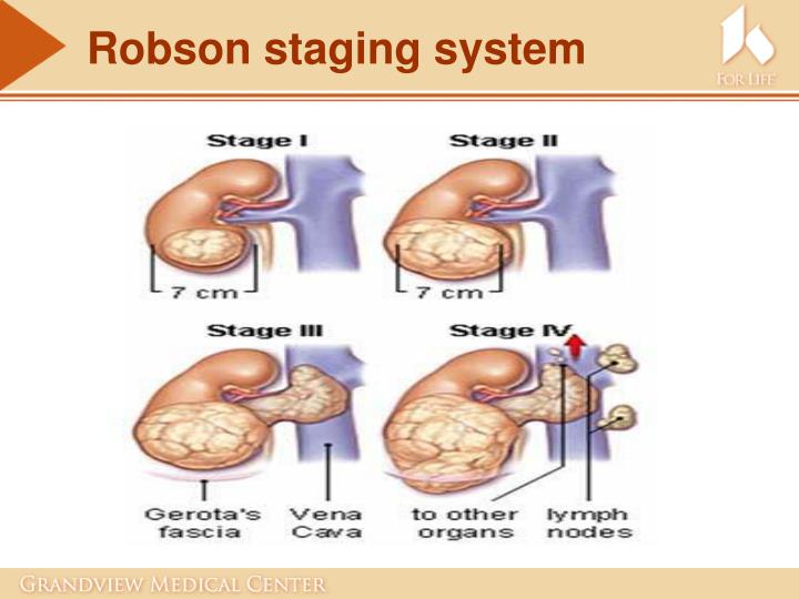 PPT - Nephrology Case Presentation PowerPoint Presentation - ID:1781902