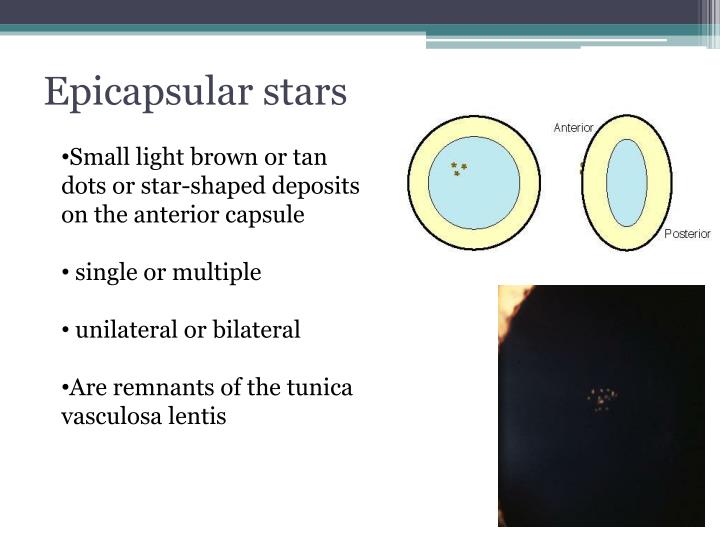PPT - Evaluation of Paediatric Cataract PowerPoint Presentation - ID ...