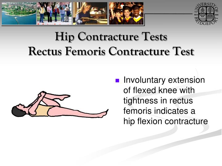 PPT - Hip Joint Orthopaedic Tests Orthopedics DX 611 PowerPoint ...