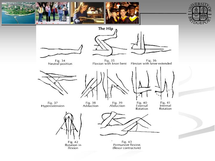 PPT - Hip Joint Orthopaedic Tests Orthopedics DX 611 PowerPoint ...
