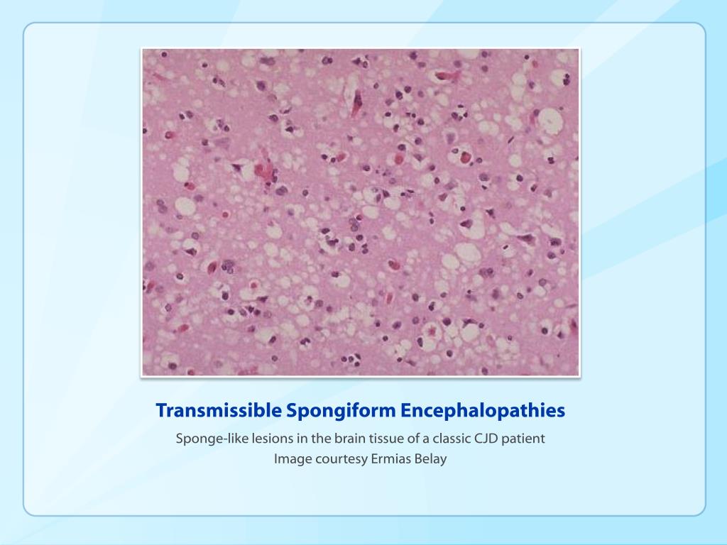 PPT - Chronic Wasting Disease: A Zoonotic Disease? PowerPoint ...