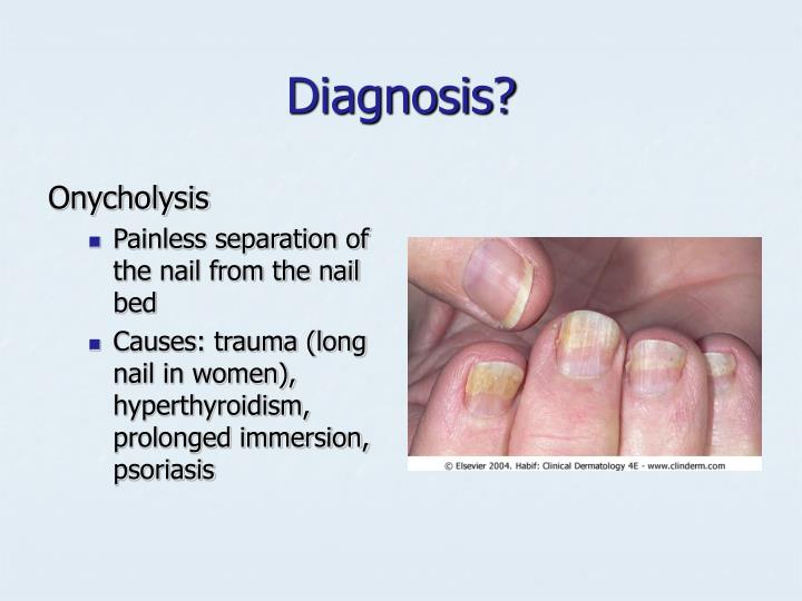 PPT - Onychomycosis PowerPoint Presentation - ID:1785081