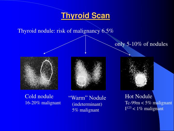 PPT - Diagnosis of Thyroid Disorders PowerPoint Presentation - ID:1785244