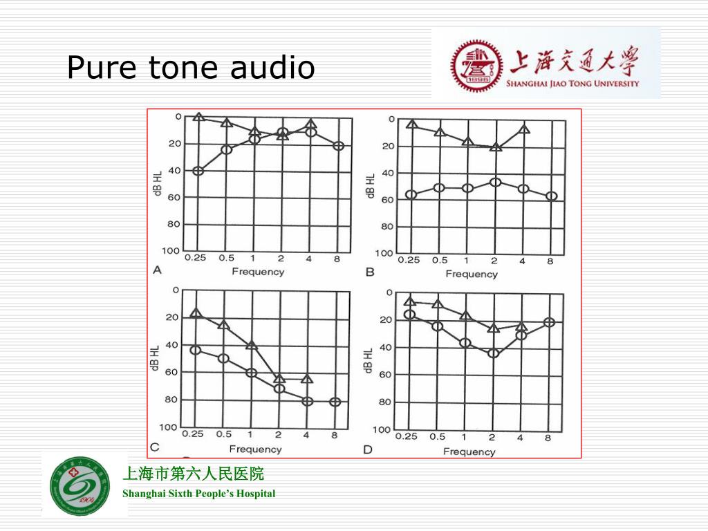 PPT - Shankai Yin Prof Dept of Otolaryngology Affiliated Sixth Hospital ...