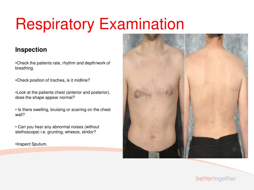 PPT - UWE Bristol Respiratory Examination PowerPoint Presentation, free ...