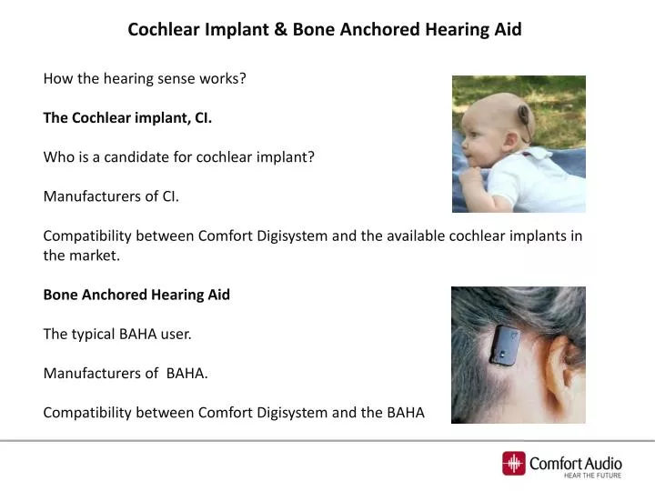 PPT - Cochlear Implant & Bone Anchored Hearing Aid PowerPoint ...