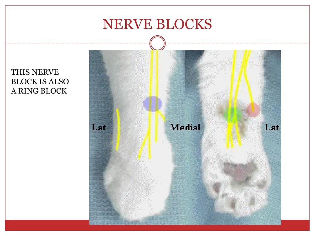 PPT - PRINCIPLES OF PAIN MANAGEMENT & ANALGESIA PowerPoint Presentation ...