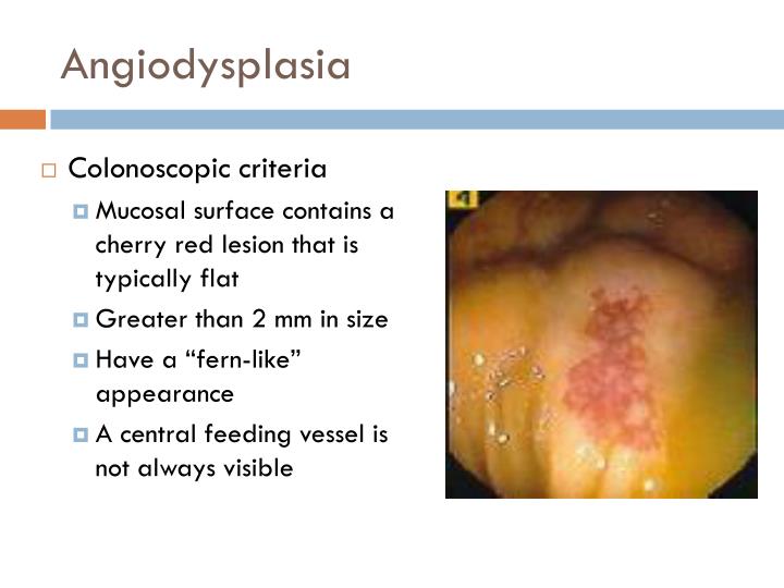 PPT - Lower GI Bleeding PowerPoint Presentation - ID:1795070