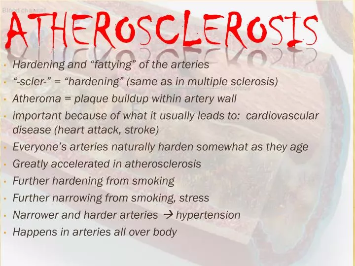 PPT - atherosclerosis PowerPoint Presentation, free download - ID:1796056