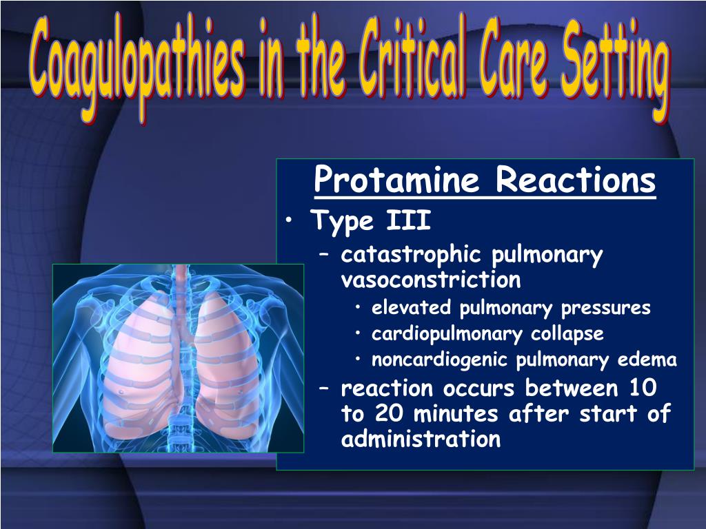 PPT - Leanna R. Miller, RN, MN, CCRN-CSC, PCCN-CMC, CNRN, CEN, NP Education Specialist LRM ...