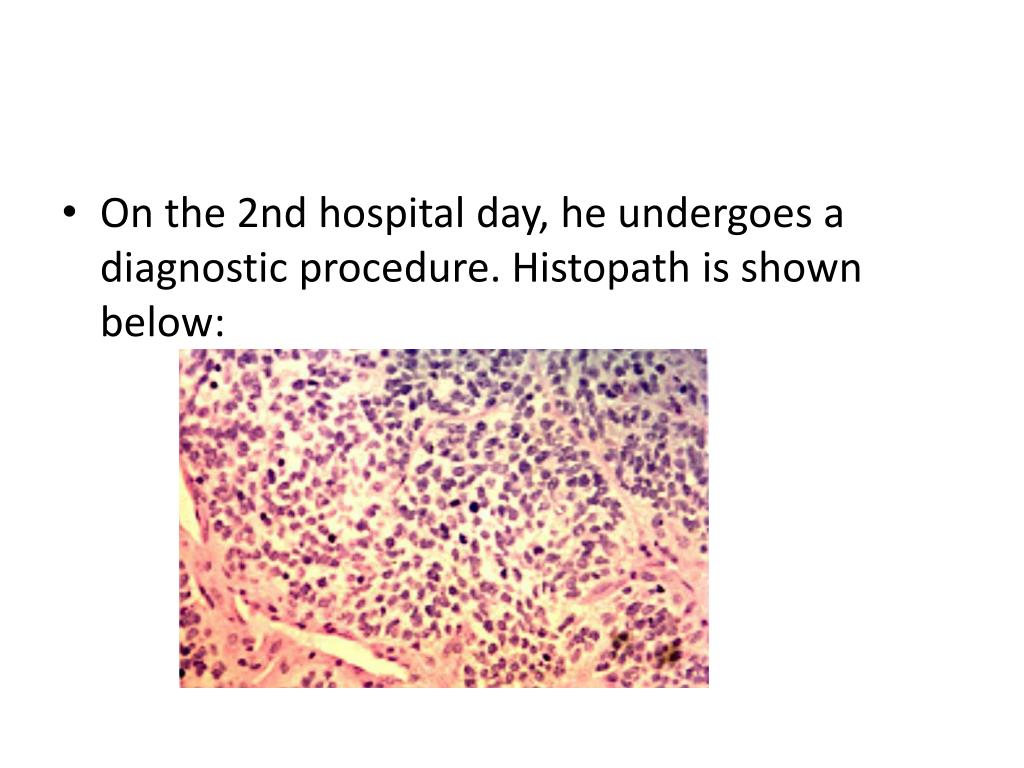 PPT - A 56-year old male farmer from Laguna is admitted because of an ...