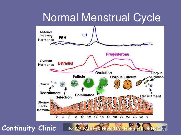 PPT - DYSFUNCTIONAL UTERINE BLEEDING PowerPoint Presentation - ID:1798954