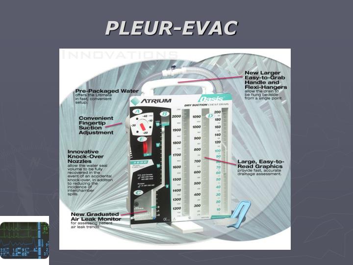 PPT - Monitoraggio postchirurgico in HDU PowerPoint Presentation - ID ...