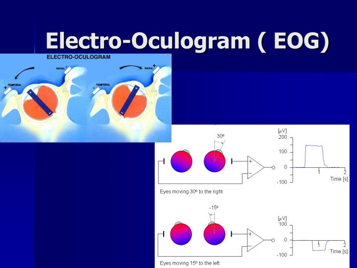 PPT - Visual Electrodiagnostic Testing-8 PowerPoint Presentation - ID ...