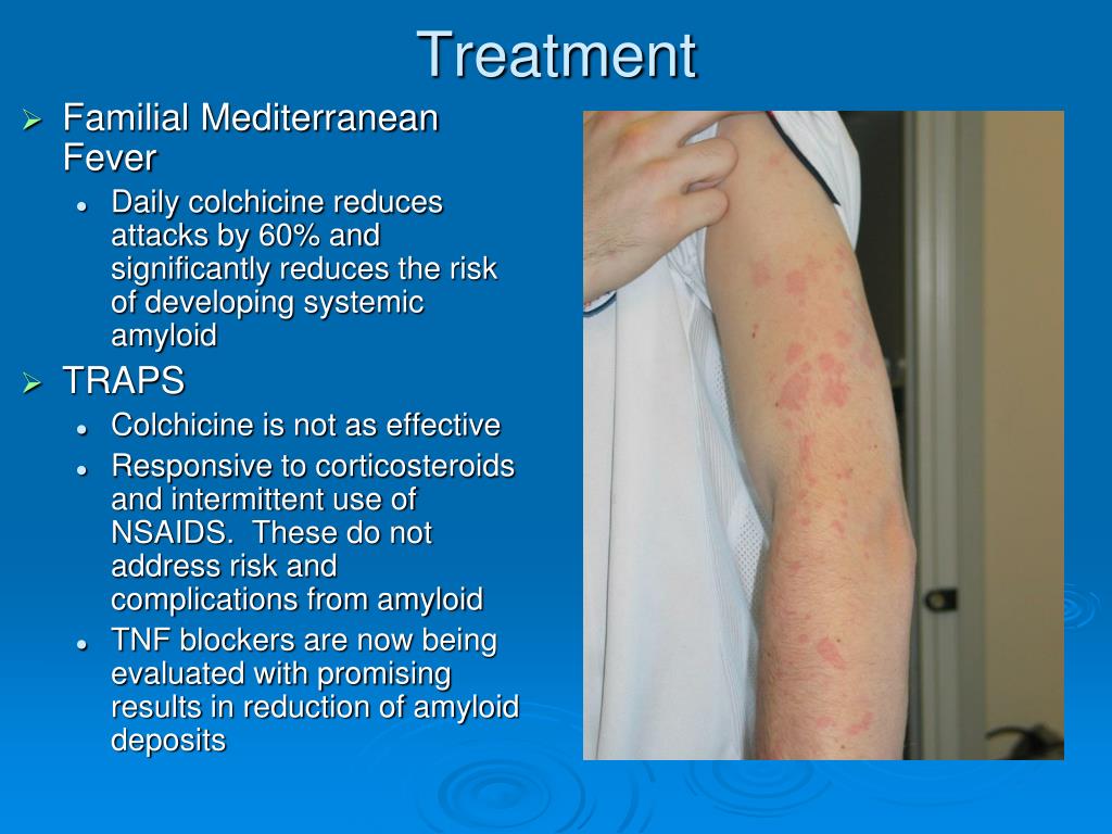 PPT - Periodic Fever Syndromes PowerPoint Presentation, free download ...