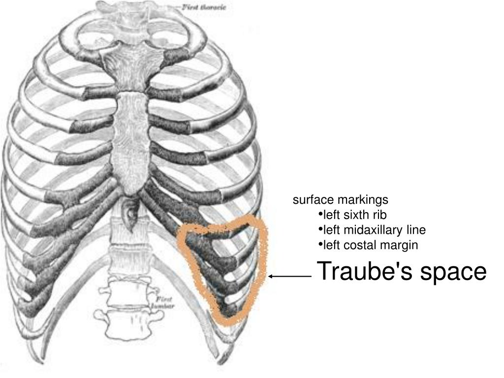 PPT - Diseases of Pleura PowerPoint Presentation, free download - ID ...