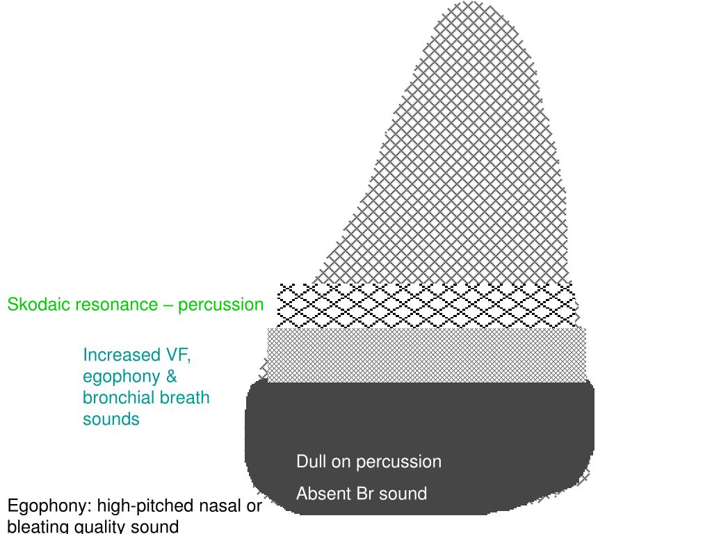 PPT - Diseases of Pleura PowerPoint Presentation, free download - ID ...