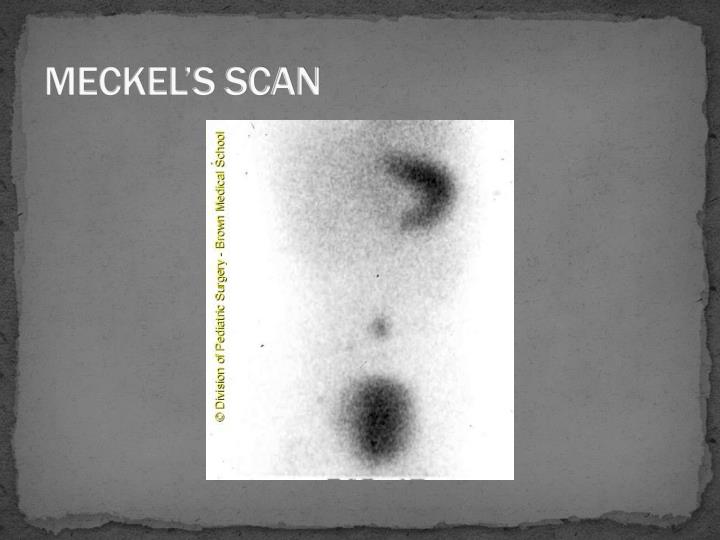 PPT - GASTROINTESTINAL BLEEDING IN PEDIATRICS PowerPoint Presentation ...