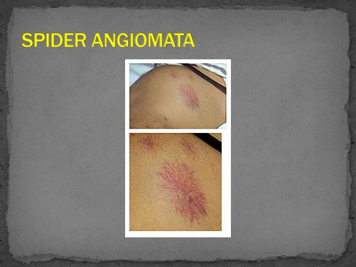 PPT - GASTROINTESTINAL BLEEDING IN PEDIATRICS PowerPoint Presentation ...