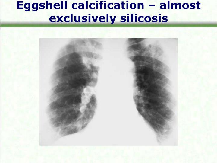 PPT - Silica Awareness PowerPoint Presentation - ID:1803396