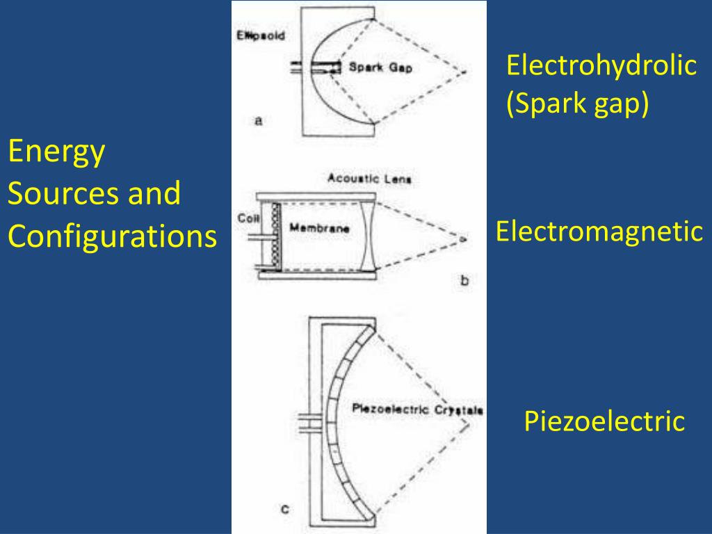PPT - Surgical Treatment of Renal and Ureteral Stones PowerPoint ...