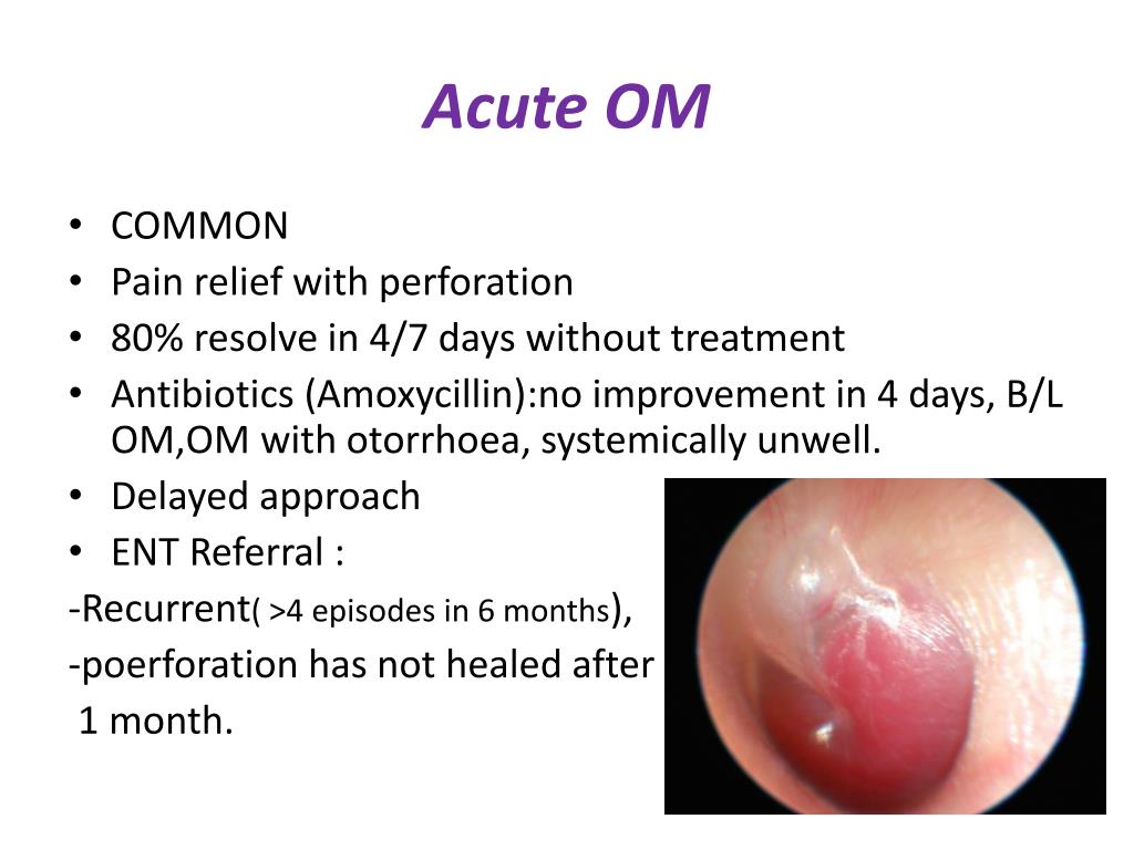 PPT - ENT UPDATE FOR PRIMARY CARE WEST CUMBERLAND HOSPITAL 05/06/2013 ...