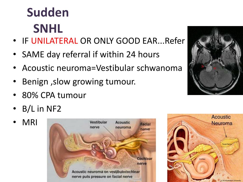 PPT - ENT UPDATE FOR PRIMARY CARE WEST CUMBERLAND HOSPITAL 05/06/2013 ...