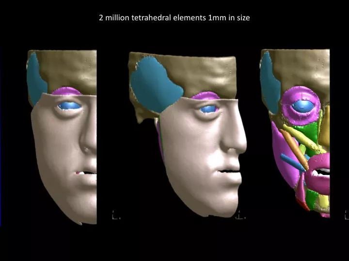 PPT - LS-DYNA simulation – facial expressions Smile – Pre-surgery ...