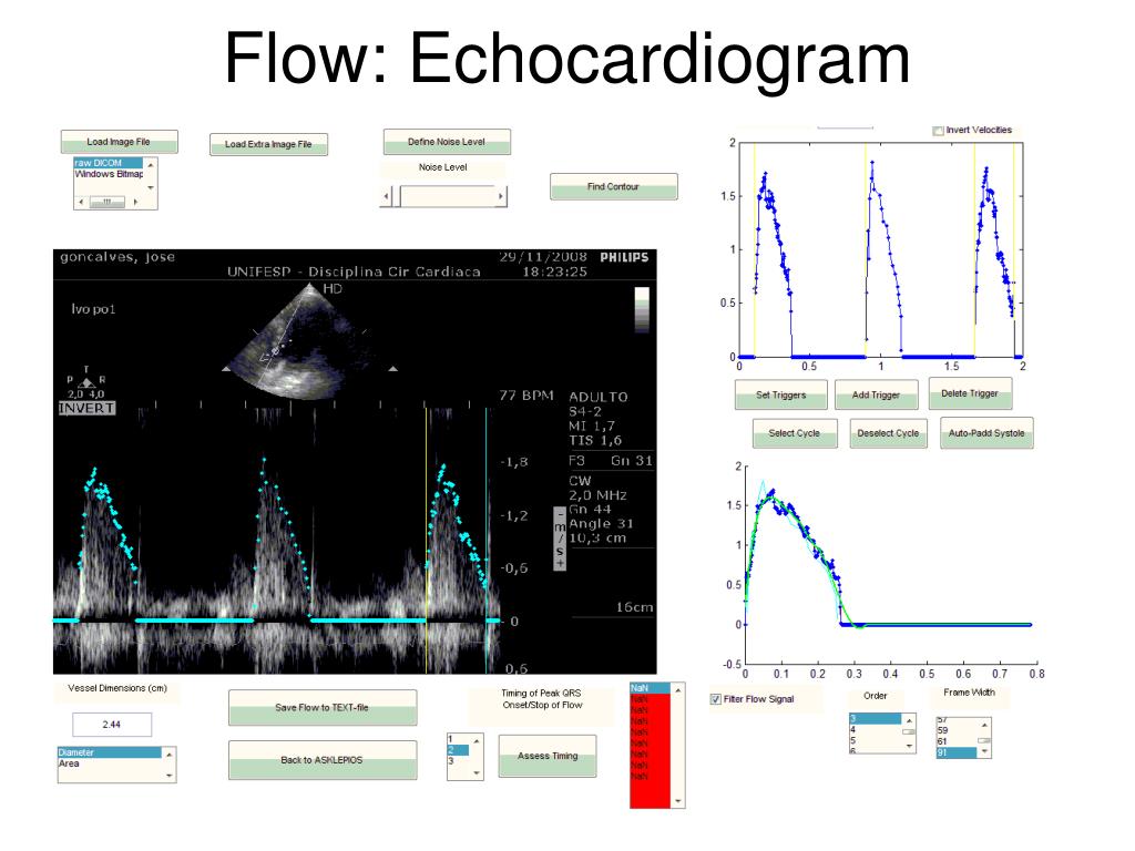 PPT - Effects of endovascular treatment of thoracic aortic diseases on ...