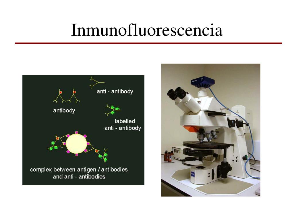PPT - Métodos de Diagnóstico Indirecto en Parasitología PowerPoint ...