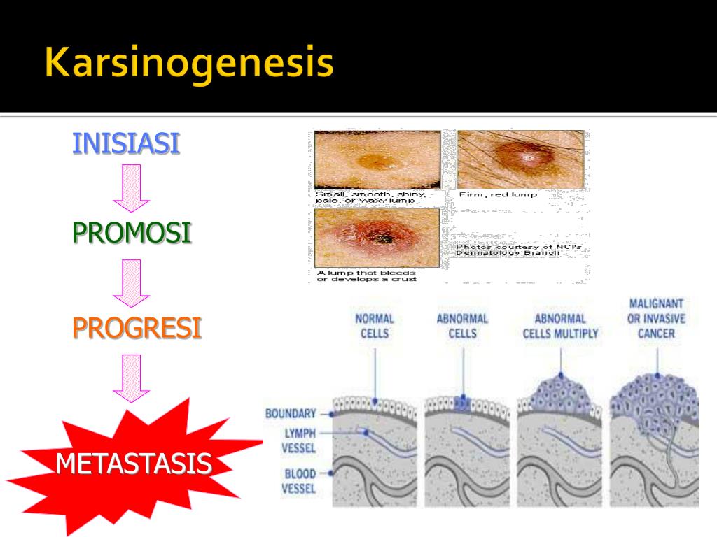 PPT - Kimia Medisinal Obat Antikanker PowerPoint Presentation, free ...