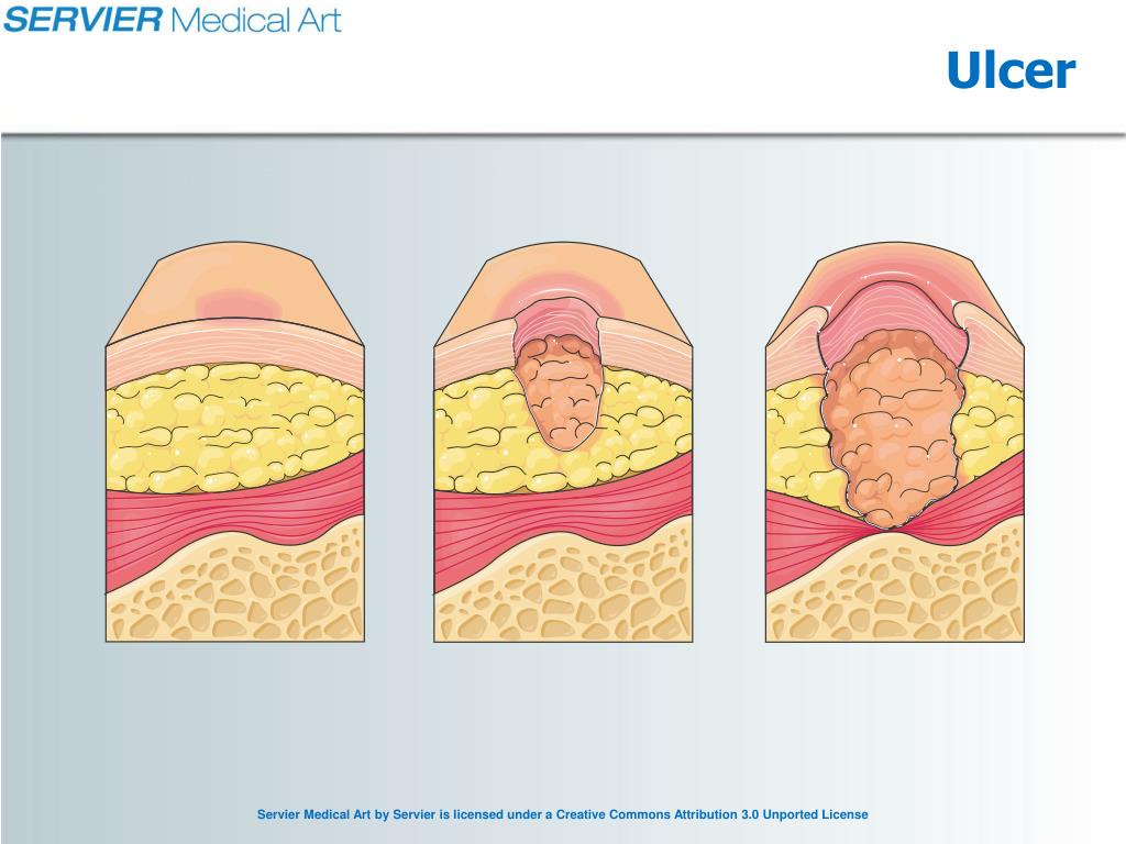 Ppt Dermatology Powerpoint Presentation Free Download Id 1810719