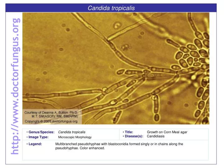 PPT - Candida tropicalis PowerPoint Presentation, free download - ID ...