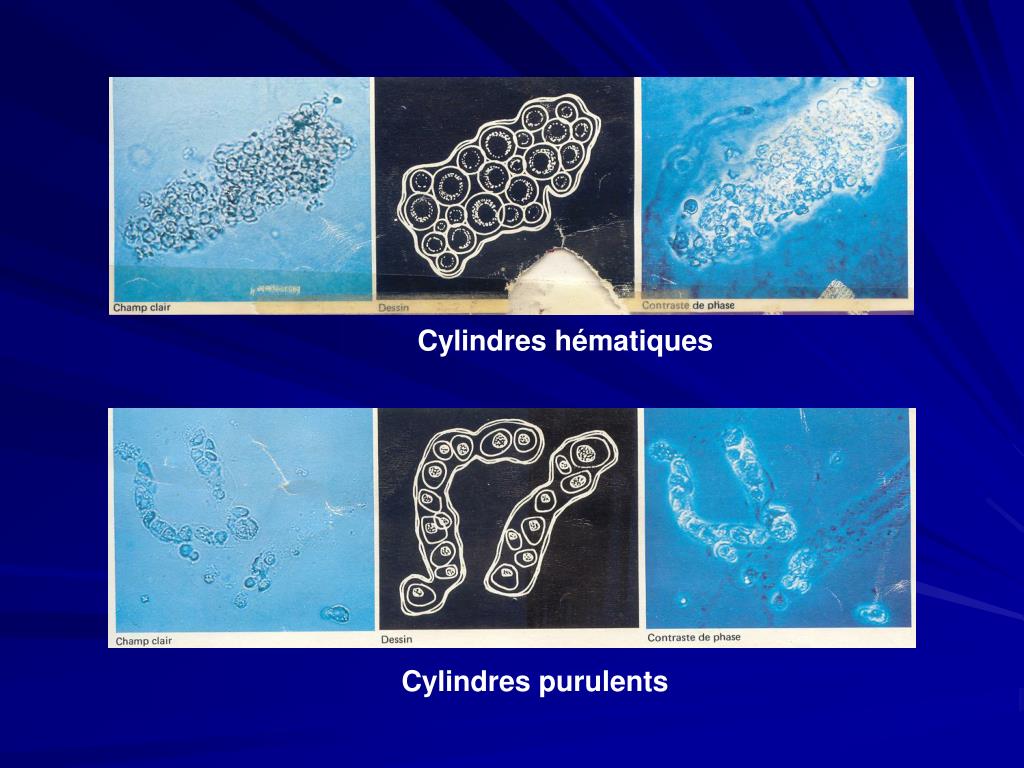 PPT - LE BILAN NEPHROLOGIQUE EN PRATIQUE PEDIATRIQUE COURANTE ...