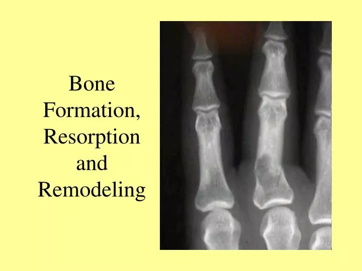 PPT - Bone Formation, Resorption and Remodeling PowerPoint Presentation ...
