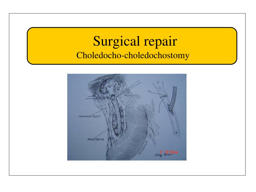 PPT - Yemeni-Turkish Surgical Congress, 30-31 May 2012, Sana’a ...