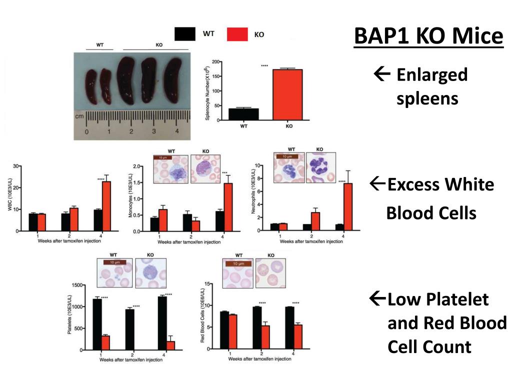 PPT - BAP1 and involvement in Mesothelioma, CMML, Uveal (eye) melanoma ...