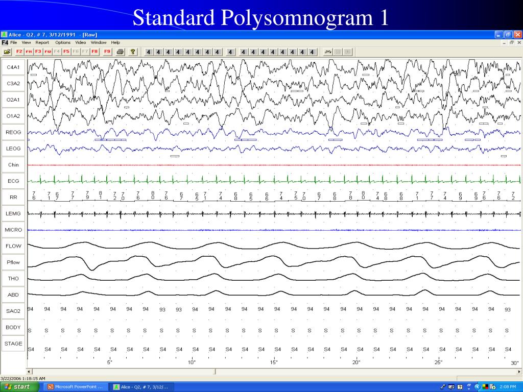 PPT - Sleep Technologists Health Care Professionals PowerPoint ...