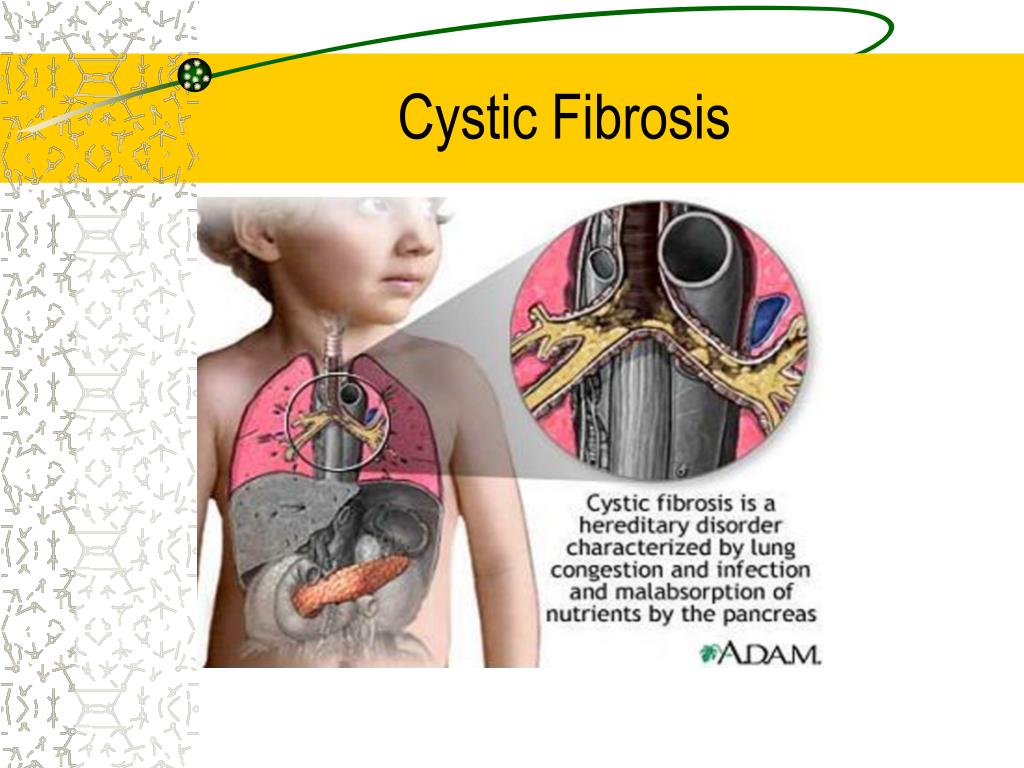 PPT - Nursing Care of the Pediatric Individual with a Respiratory ...